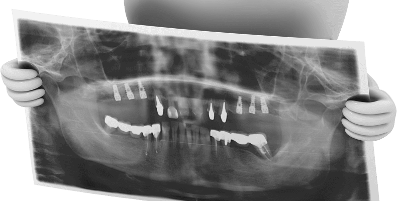 Services | Milford Family Dentistry